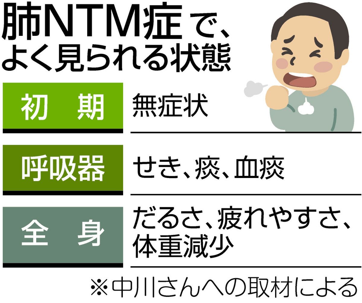 長引くせき、痰… 肺NTM症かも 細菌感染 遅い進行 気付きにくく：中日新聞Web