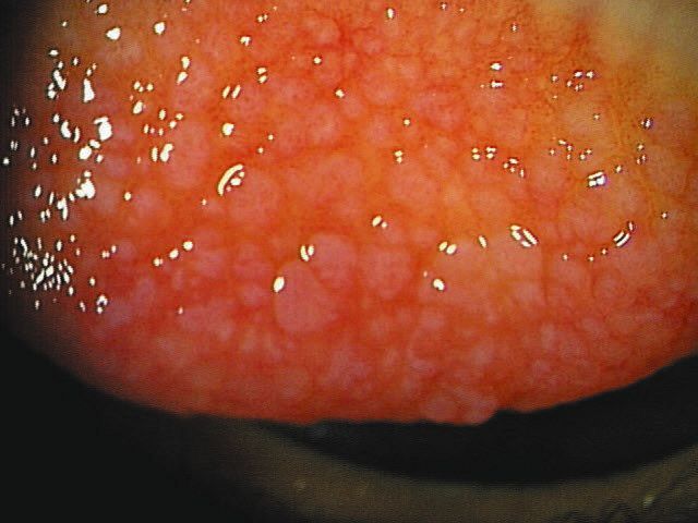 ネットで手軽に入手 カラーコンタクト レンズきちんとケアを ：中日新聞Web